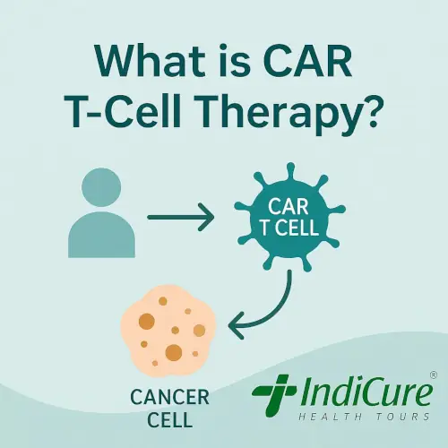 CAR T-Cell Therapy in India: Affordable Cancer Treatment